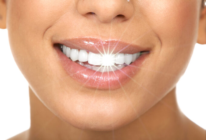 Improving Your Smile With Invisalign ─ Advantages of Invisalign Treatment