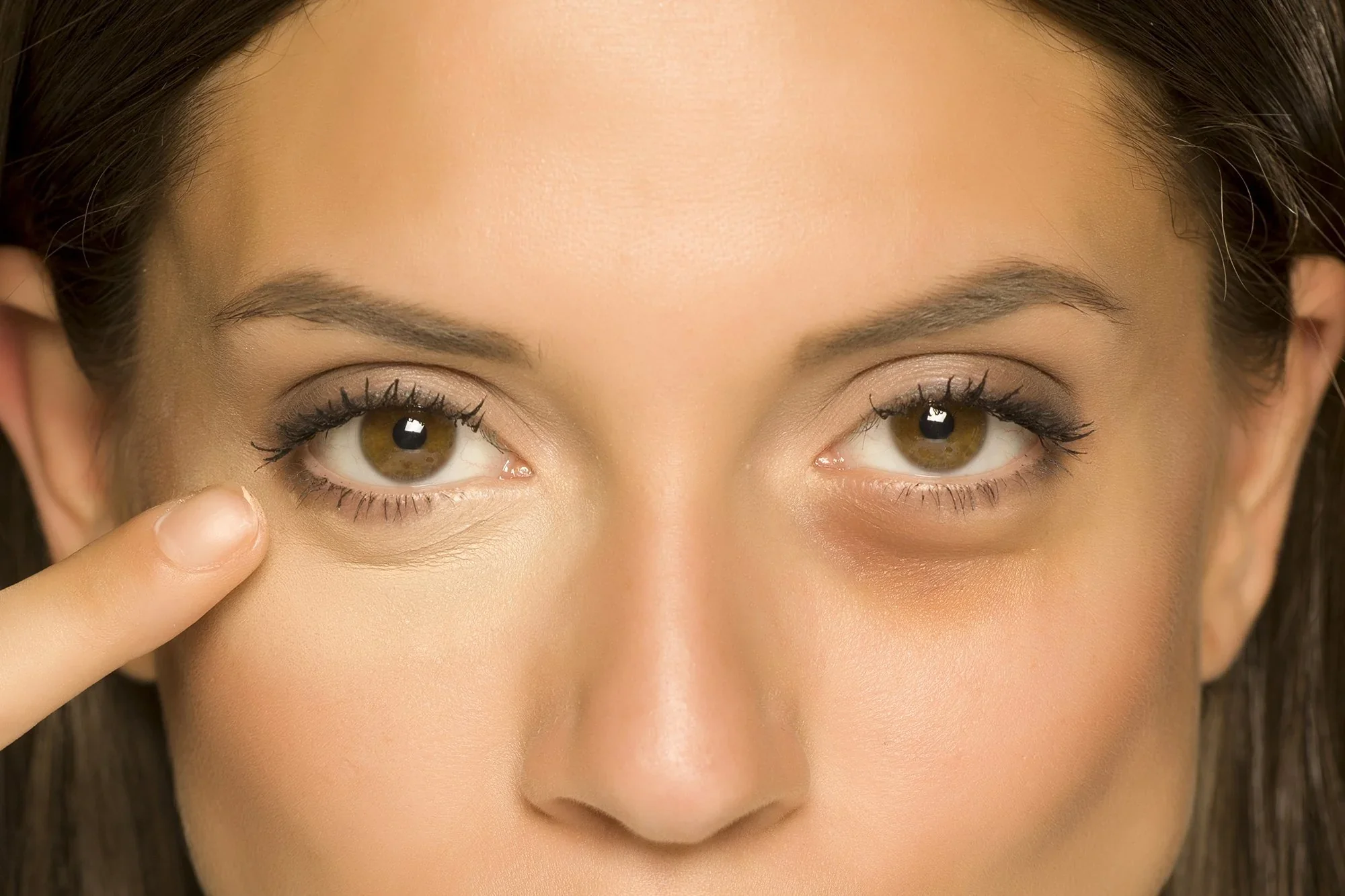 Reduce Eye Bags with Non-Surgical Treatments A Guide to Restoring a ...